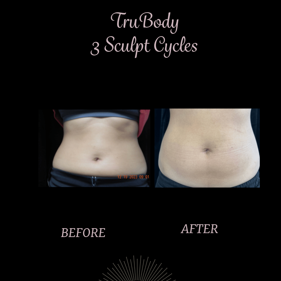 truBody Treatments In Anchorage | Create Your Dream Body